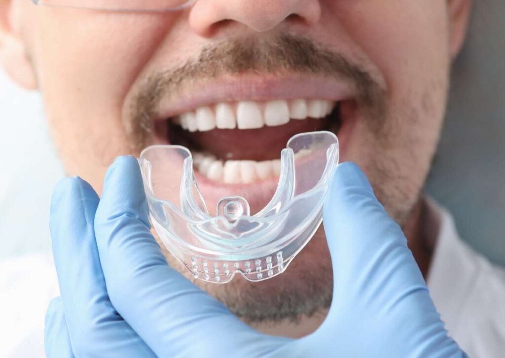 Custom Night Guards for Teeth Protection | Bohemia Dental Arts